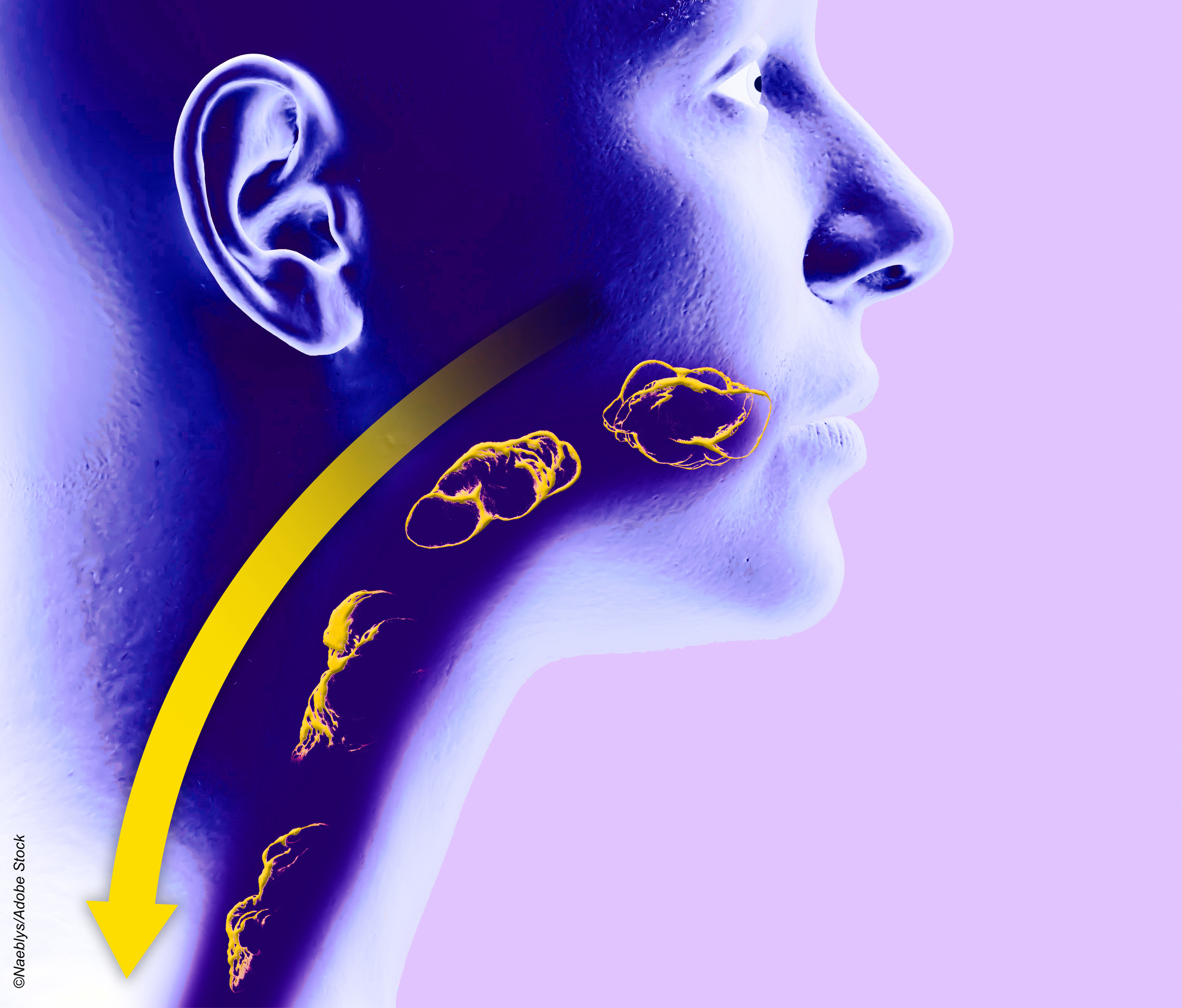 Can I-SEE Help Track Disease Severity in Patients with EoE?